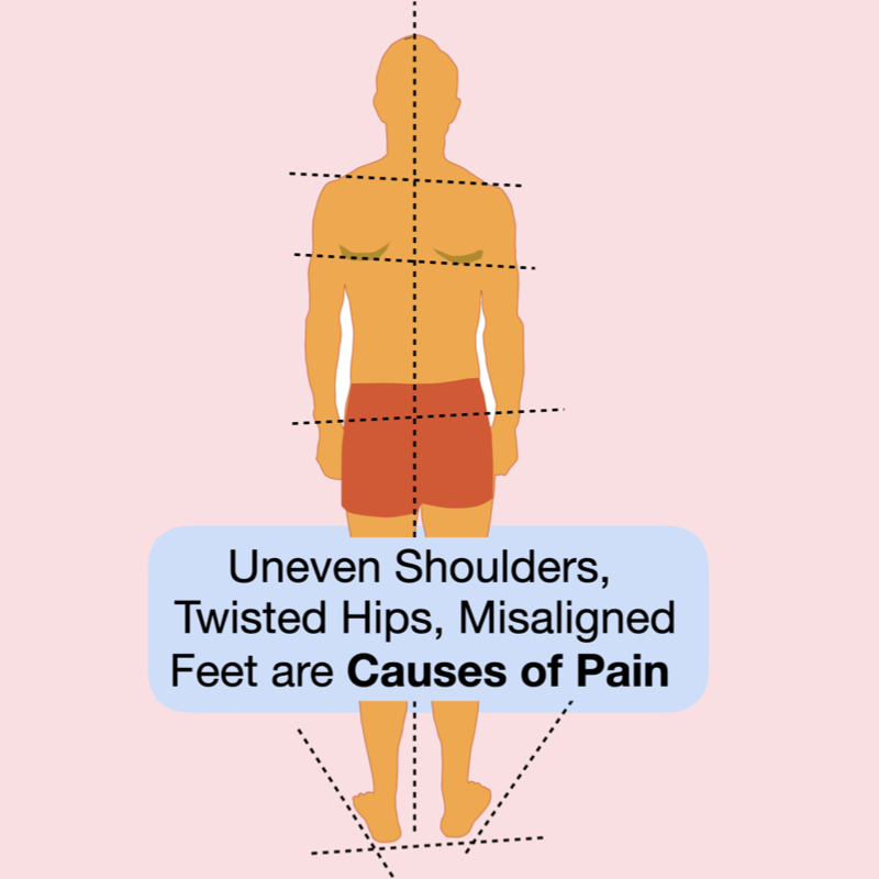 Posture Alignment Therapy | Eliminating the Cause of Pain
